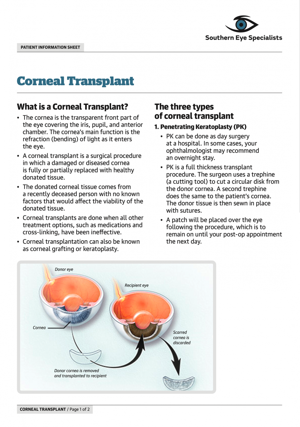 Fact Sheets - Southern Eye Specialists